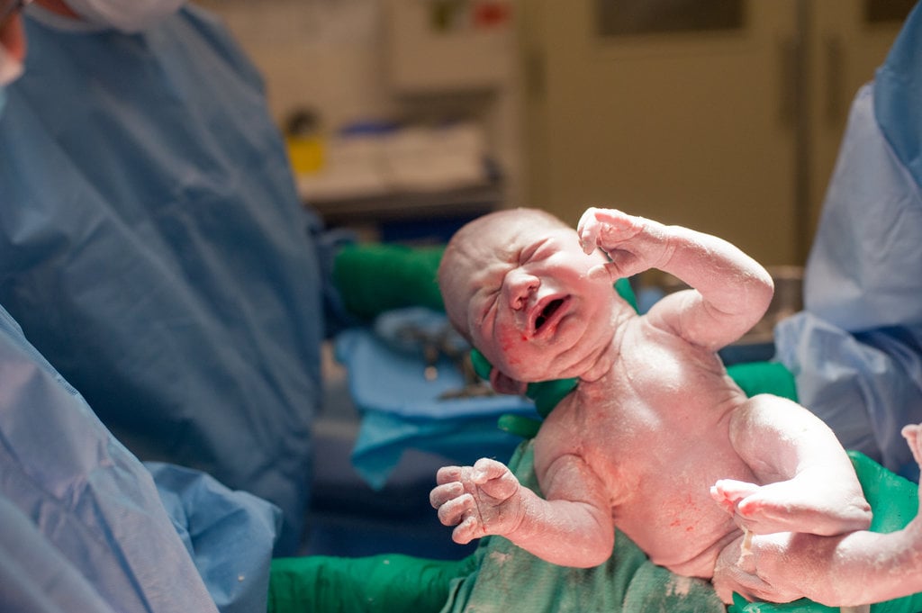 Risks of Vaginal Swabbing For C-Section Babies | POPSUGAR Family